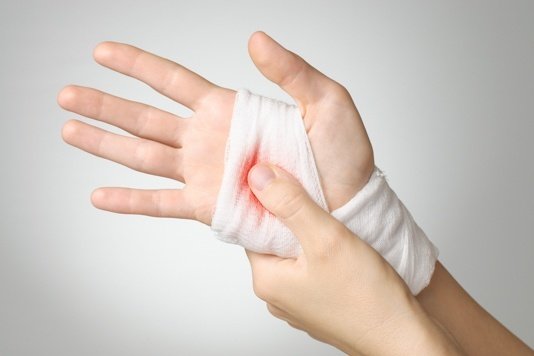 How do I deal with bleeding wounds? - HTS First Aid Training